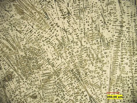 Sheffield Metallurgical Services Ltd On Linkedin Metallurgy Microstructure Implants Medical