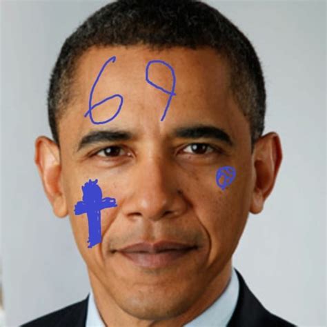 Stream X Ray Balls Music Listen To Songs Albums Playlists For Free