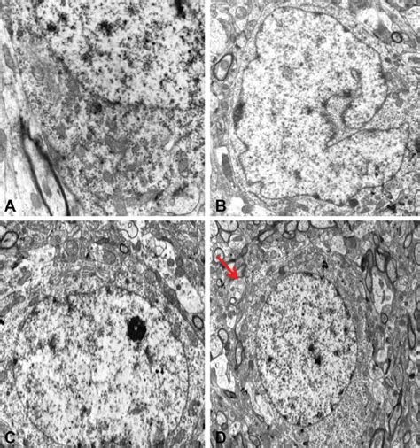 Transmission Electron Microscope Tem Analysis Of The Brain Cortex Download Scientific Diagram