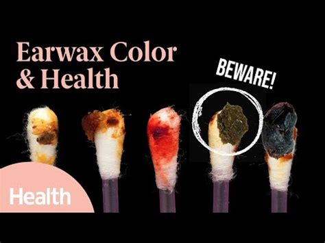 What Does Having Black Ear Wax Mean