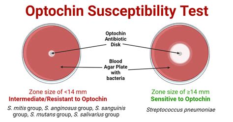 Streptococcus Salivarius Hemolysis