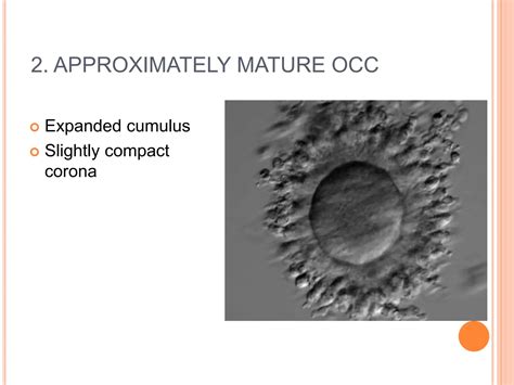 Oocyte Gradingpptx Dhsvsusvshshhshsh Pptx