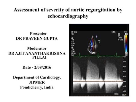 Echocardiography Assessment Of Aortic Regurgitation Severity Pptx