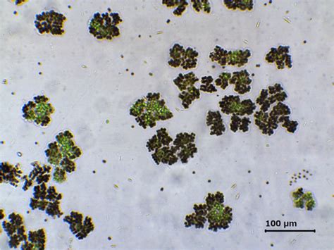 Morphology Of Microcystis Wild Strain Download Scientific Diagram