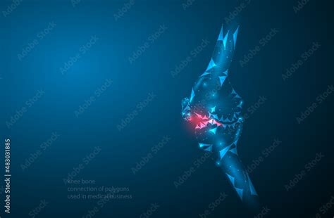 Knee Bone Polygon Connection Used In Medical Business Stock Vector Adobe Stock