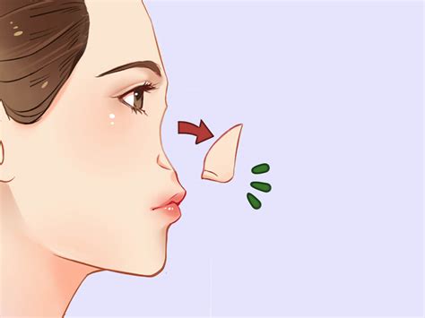 Will My Nose Drop After A Nose Job Erufu Care