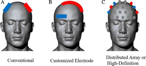 Schematic Classification Of Personalized Tdcs For Motor Recovery
