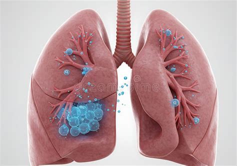 Lungs Oxygen Diffusion Stock Illustration Illustration Of Orange