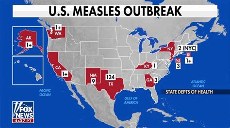 Get Latest Measles Case Counts By State Amid Us Outbreaks Fox News