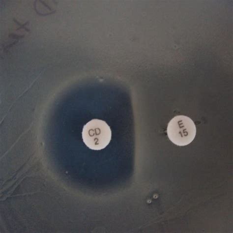 Pdf Inducible Clindamycin Resistance In Clinical Isolates Of Staphylococcus Aureus