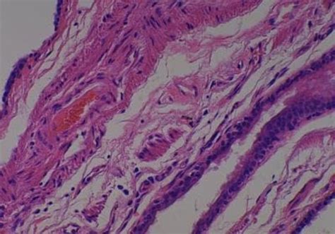 Novus Biologicals Human Lung Tissue Microarray Normal Human Lung