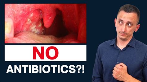 Antibiotics For Strep Throat Do We Need Them Youtube
