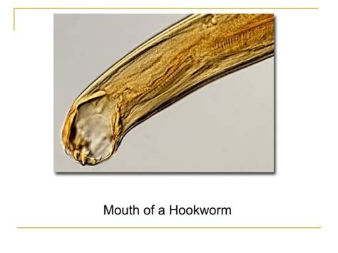 Ancylostomiasis Ppt Infectious Diseases Diseases And Conditions