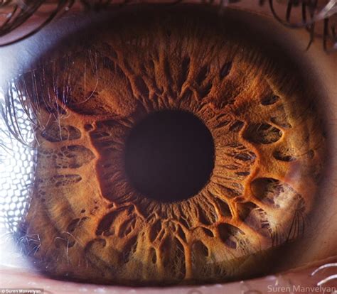 Weird Eye Iris