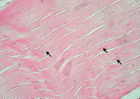 Dense Regular Connective Tissue