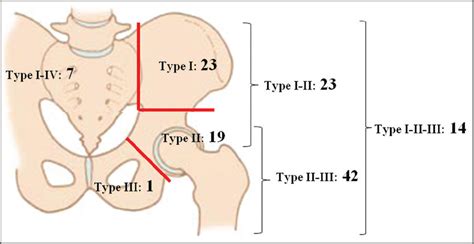Types Of Pelvic Resection According To Enneking And Dunham 2 Download Scientific Diagram