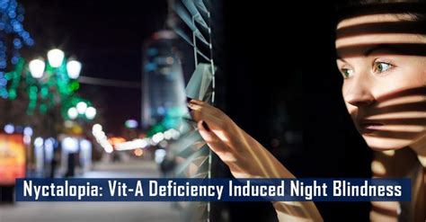 What Are The Prospective Causes Of Nyctalopia Medsynapse