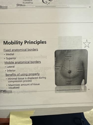 Mammography Day 5 Flashcards Quizlet Mammography Day 5 Flashcards Quizlet