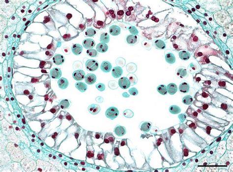 Anther Definition And Examples Biology Online Dictionary