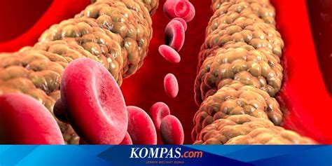 Kadar Trigliserida Tinggi Menyebabkan Apa