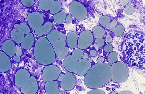 Human Fat Cells Light Micrograph Stock Image C029 6630 Science