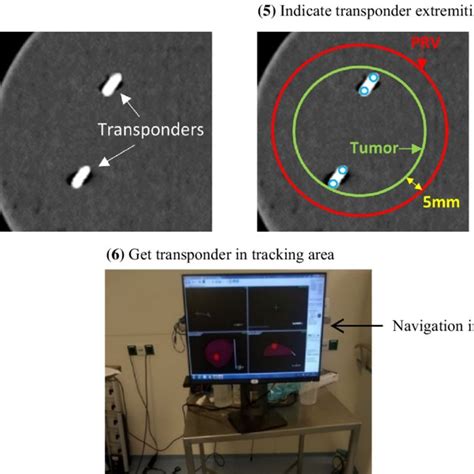 The 6 Step Workflow To Prepare The Navigation Each Step Number Is