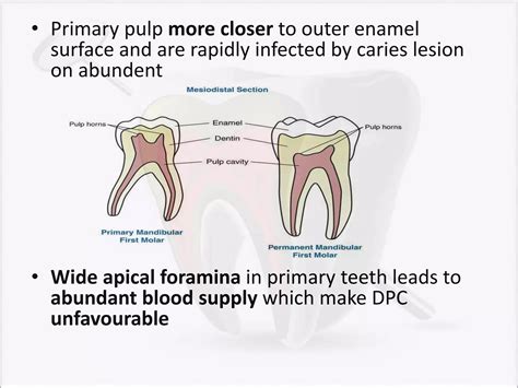 Direct Pulp Capping Pptx Dental Health Diseases And Conditions