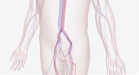 Premium Photo Right Heart Catheterization Involves A Catheter That Is