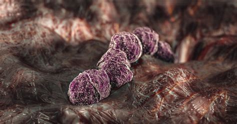 Informatii Despre Infectia Cu Streptococ Beta Hemolitic Grup B