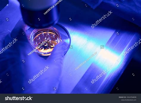 Intra Cytoplasmic Structures Photos And Images And Pictures Shutterstock