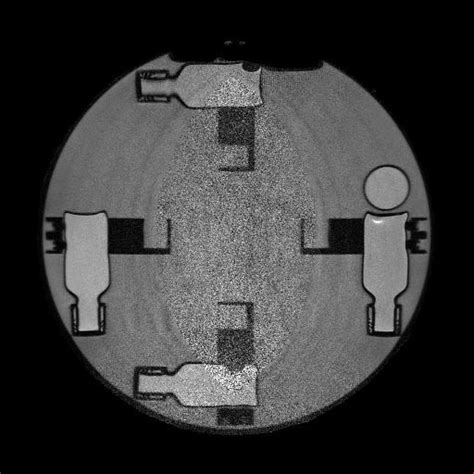 Reconstruction From Sensitivity Encoded Phantom Data A Image