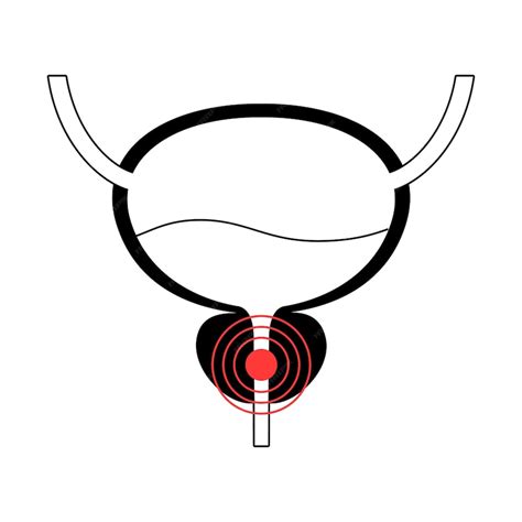 Premium Vector Prostatitis Inflammation Problem