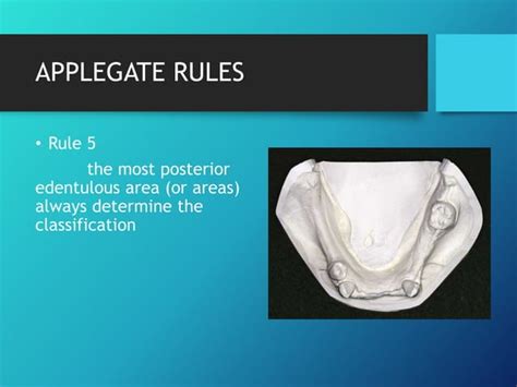 02 Kennedy Classification Pptx Dental Health Diseases And Conditions