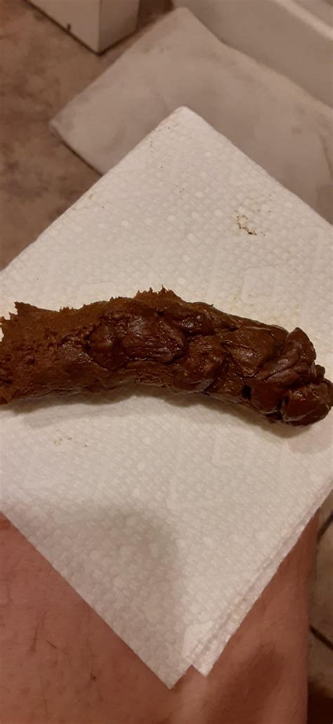 C Diff Pcr Positive Toxin Negative Rpoop