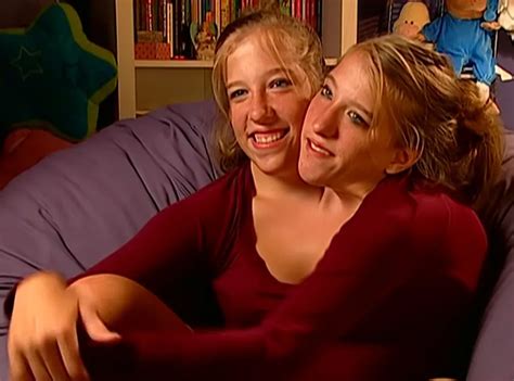 What To Know About Conjoined Twins Abby Hensel And Brittany Hensel
