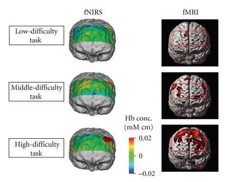 Functional Brain Imaging By Fmri And Fnirs Download Scientific Diagram