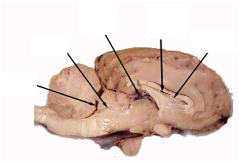 Lateral Section Sheep Brain Diagram Quizlet