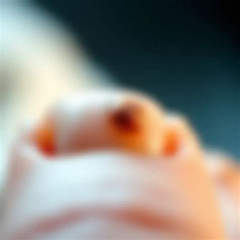 Close Up View Of Pitted Fingernails