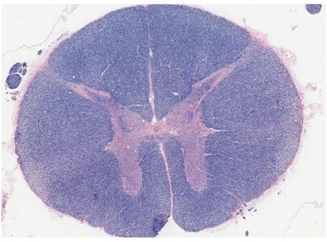 Cross Section Of The Spinal Cord Microscopic View Anatomy Note