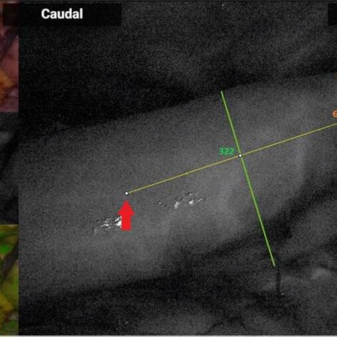 Screen Shot Image From Representative Video Of The Proximal Conduit In Download Scientific