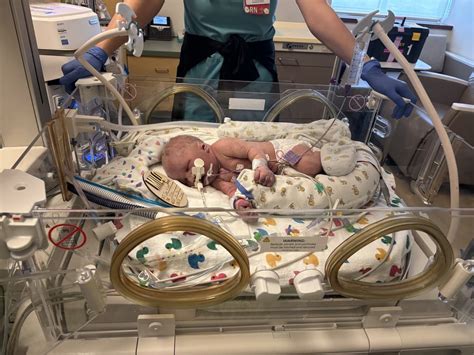 Our Miracle Milo James