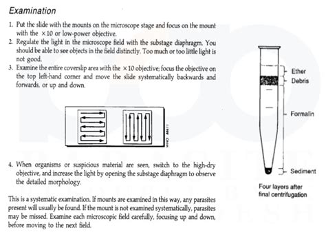 Proper Way Of Examining Fecal Slide For Parasitic Stages Under
