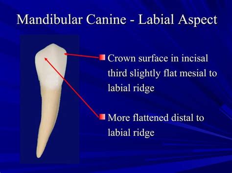 Maxillary And Mandibular Canines Ppt