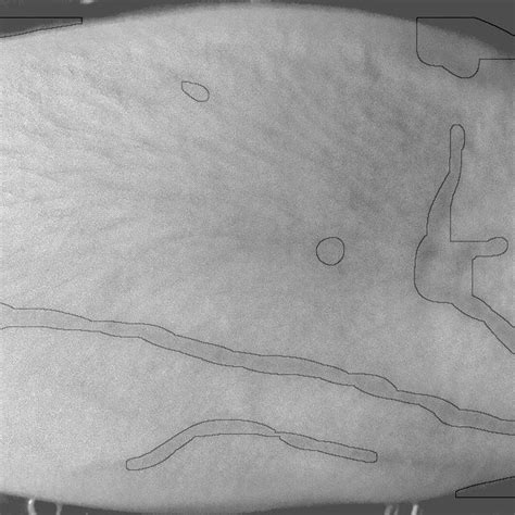 result of the vein detection algorithm in the acf region download