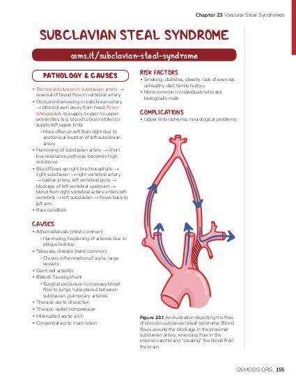 Coronary Subclavian Steal Syndrome Wmpvd