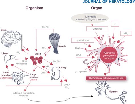Figure 2 From Hepatic Encephalopathy In Patients With Acute