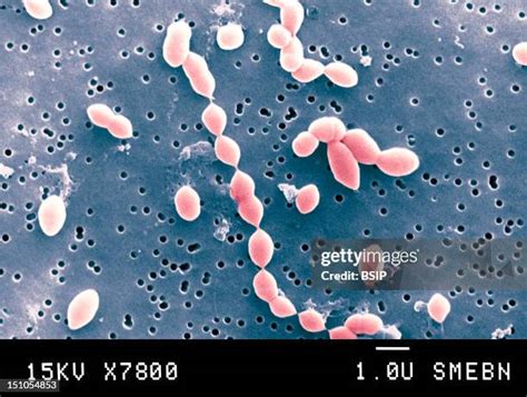 Pneumococcus Photos And Premium High Res Pictures Getty Images