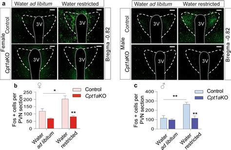 Cpt1a In Agrp Neurons Is Required For Sex Dependent Regulation Of
