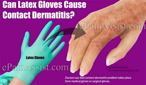 Can Latex Gloves Cause Contact Dermatitis