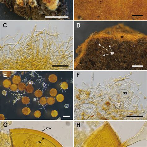 Rhizophagus Irregularis A A Sporocarp With Yellow Swollen Structures